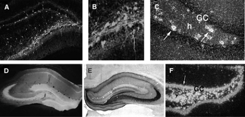 New Therapeutic Directions | Neupsy Key