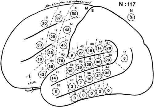 Intraoperative Functional Mapping | Neupsy Key