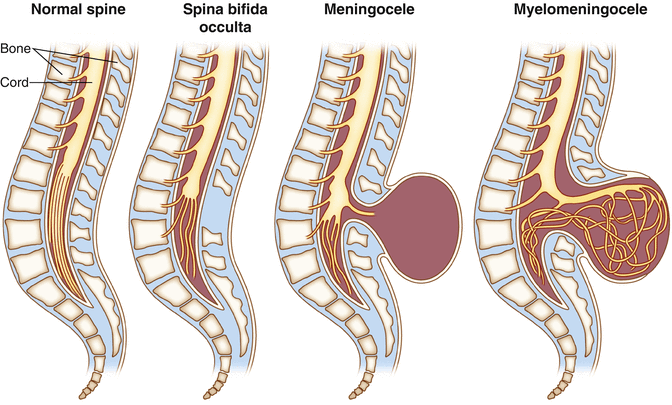 Intraoperative Monitoring For Surgery Of The Spinal Cord And Cauda Equina Neupsy Key