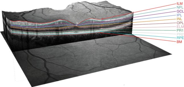 Basic principles of optical coherence tomography | Neupsy Key