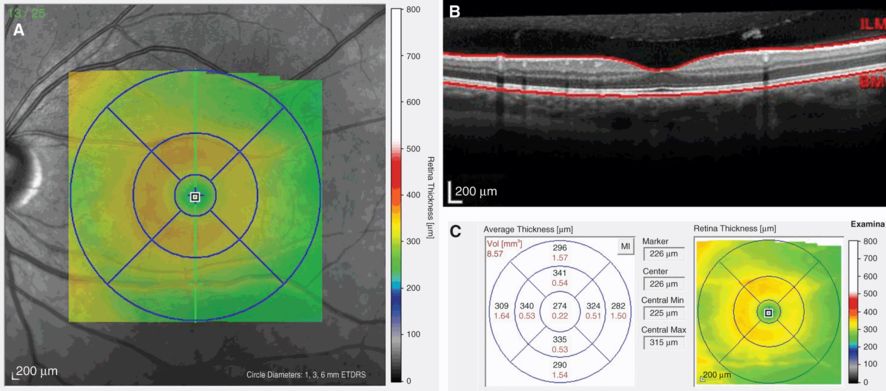 Anatomy of the anterior visual pathway | Neupsy Key