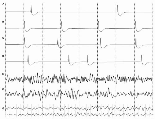 The Normal Adult EEG | Neupsy Key
