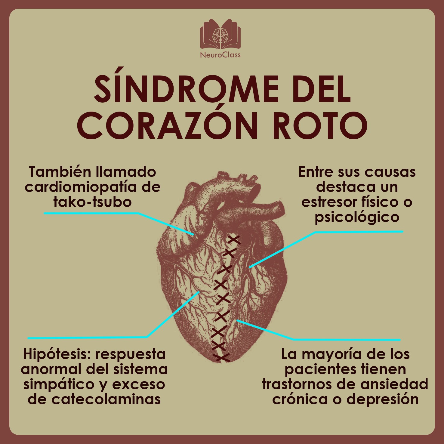 El síndrome del corazón roto - NeuroClass