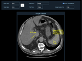 Dicom Viewer For Nextcloud Continues To Make Progress Nextcloud