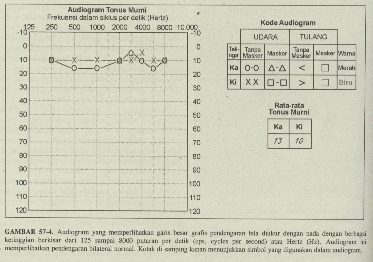ANATOMI FISIOLOGI TELINGA | NURSE IDEA