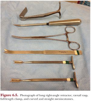 Technique: Modified McIntosh | Obgyn Key