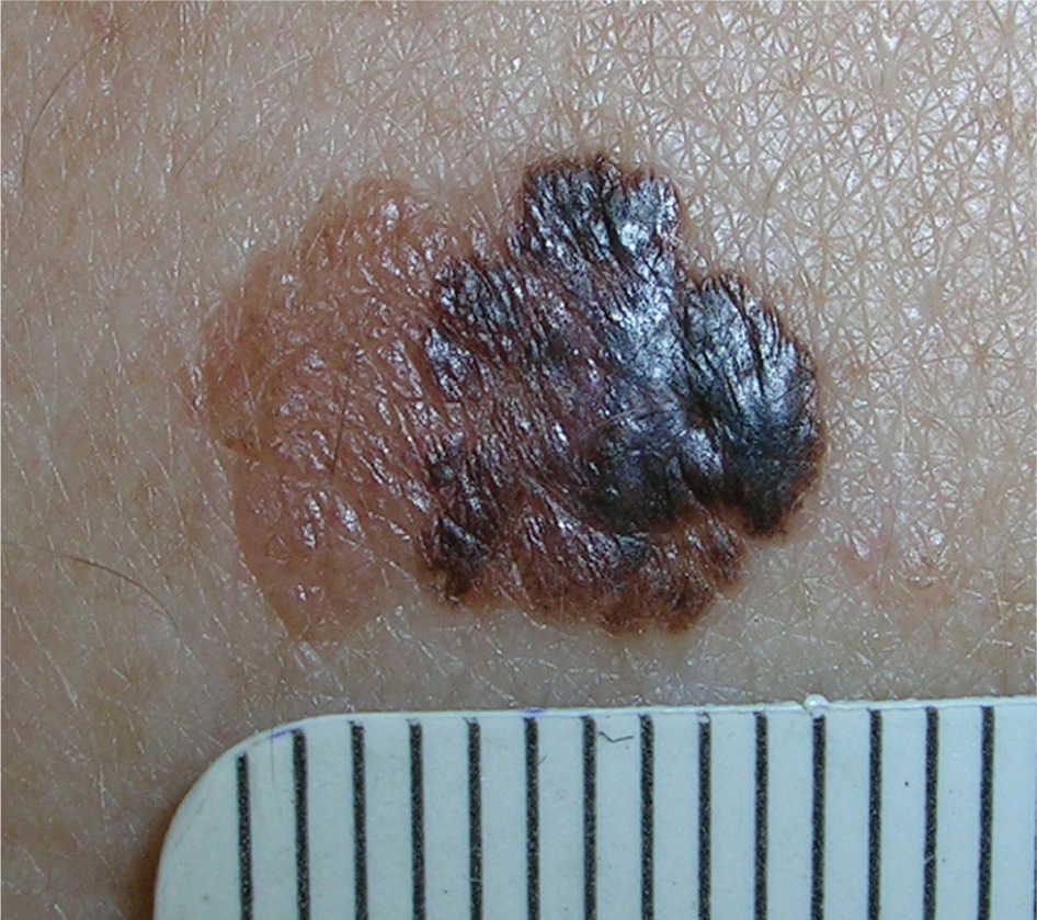 Dermatologic Diseases | Obgyn Key