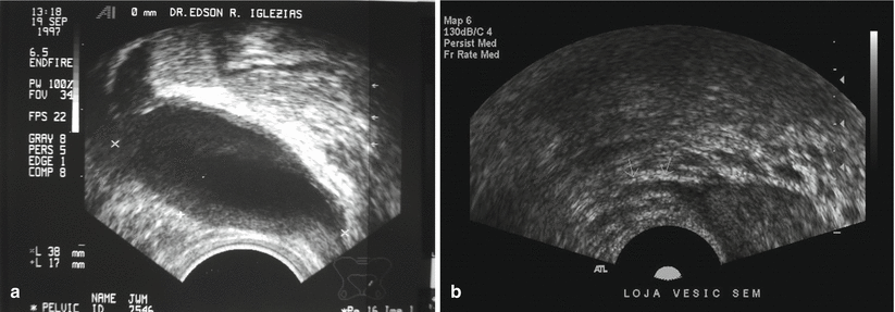 Non-obstructive Diseases of the Testes | Obgyn Key