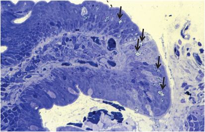 Intestinal protozoa | Oncohema Key