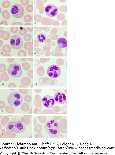 Neutrophils, Non-Clonal Abnormalities | Oncohema Key