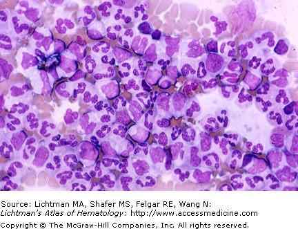 Other Non-Hematopoietic Cells in Blood (new section) | Oncohema Key