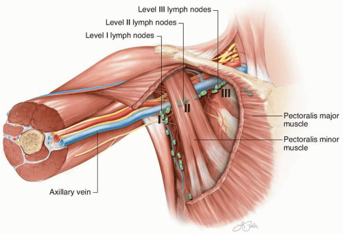 Posterior Axillary Lymph Nodes Posterior Axillary Lymph Nodes