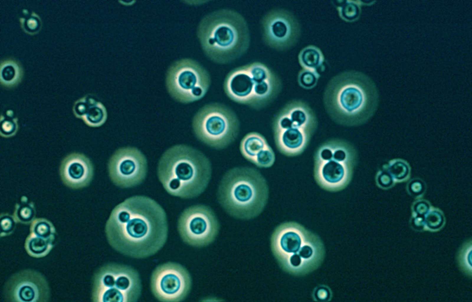 Tudo Sobre Criptococose: Sintomas, Tratamento, Prevenção e Mais | Saúde ...