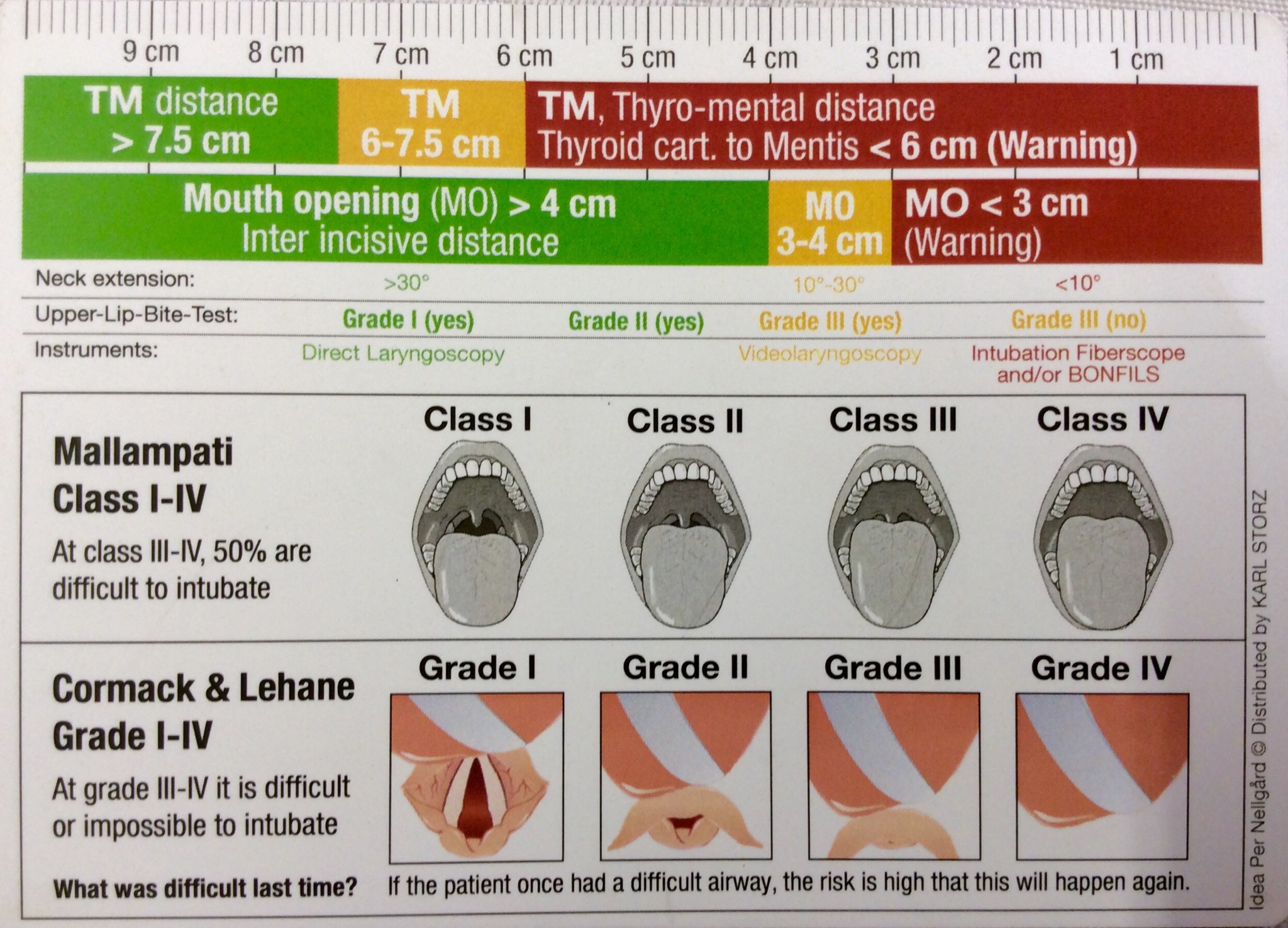 Thyromental Distance OpenAirway thyromental-distance-openairway