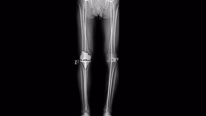 JBJS Essential Surgical Techniques Awards - OrthoBuzz