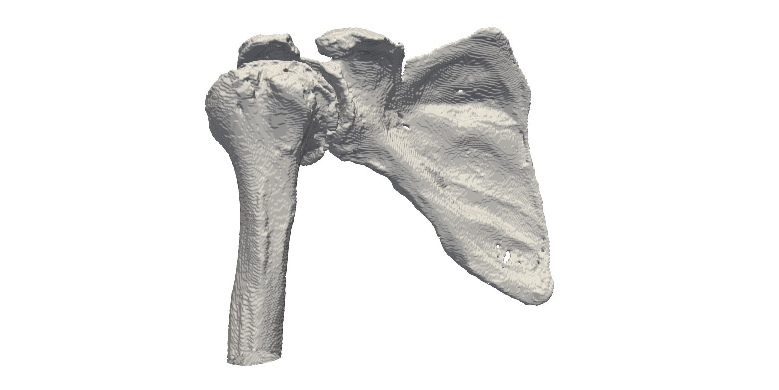 RSIP Vision Launches a Breakthrough AI-Based Shoulder Replacement ...