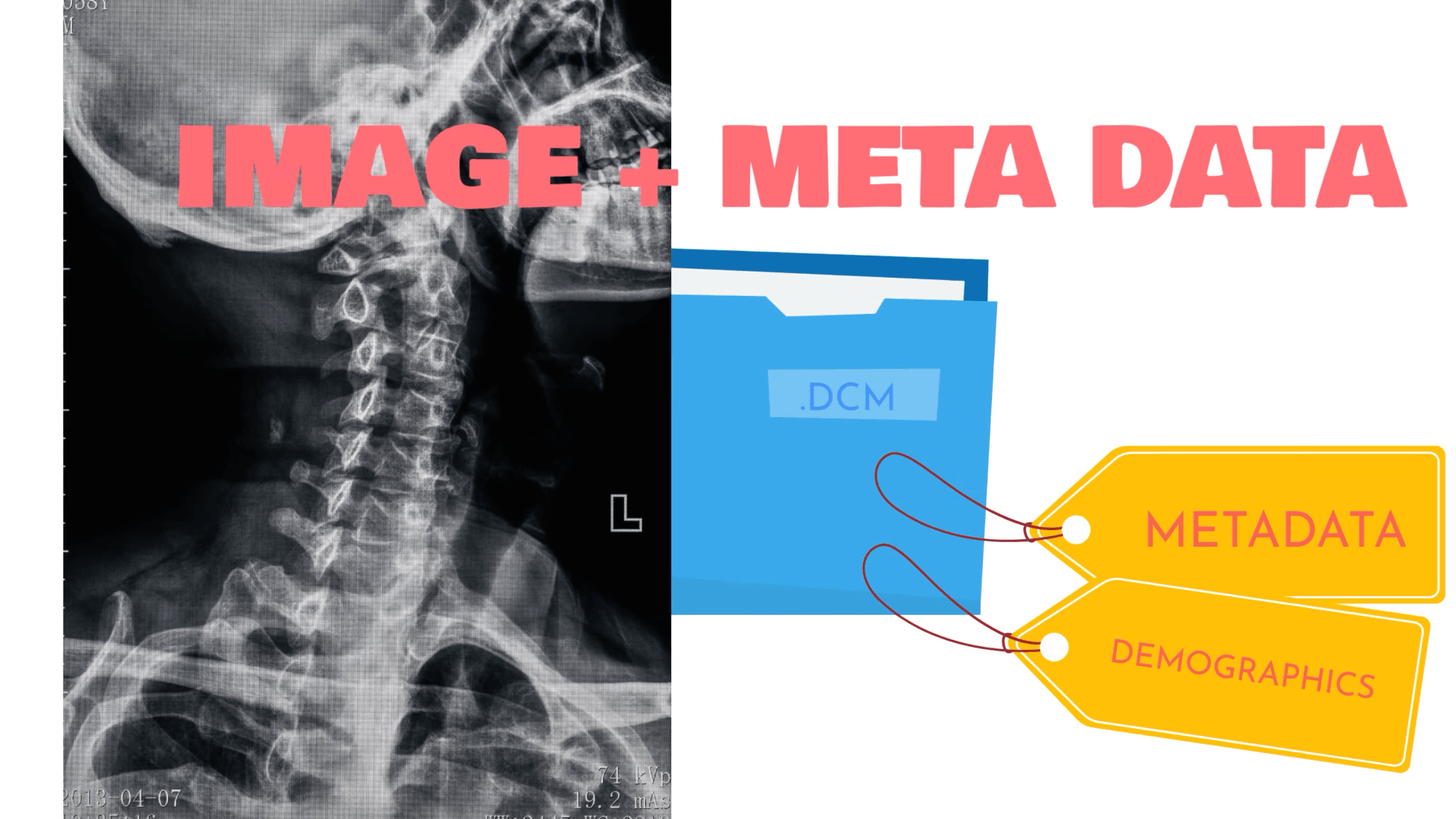 What is a DICOM Tag – PACS Boot Camp