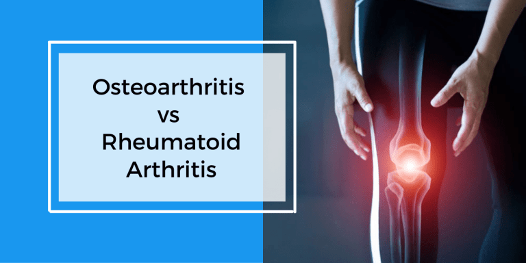 Osteoarthritis vs Rheumatoid Arthritis - Comparing the Two