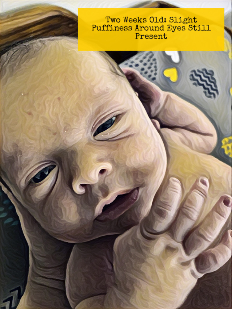 Your Baby's Eyes: 11 Strange (but harmless) Newborn Quirks • Parenting ...