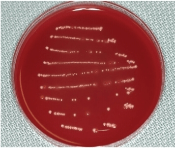 What are Anaerobic Bacterial Infections? - Pathosomes