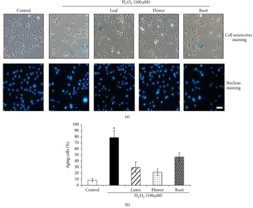 What is Cellular Aging? - Pathosomes