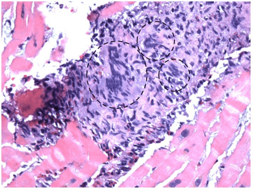 What is Cardiogenic Shock? - Pathosomes