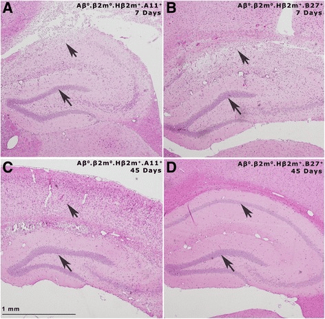What is Chronic Neuronal Injury? - Pathosomes