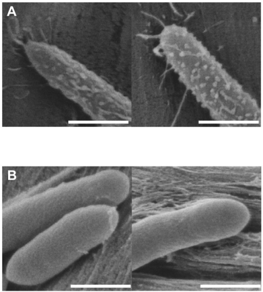 What are Clostridial Infections? - Pathosomes