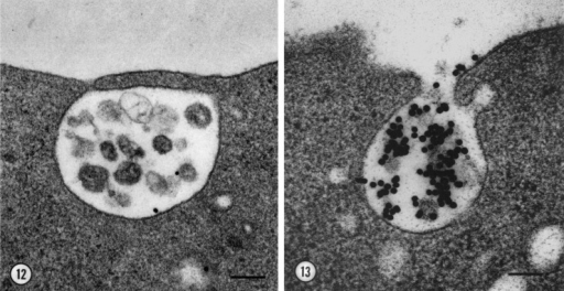 What is Exocytosis? - Pathosomes