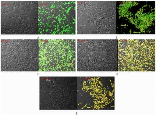 What are Gram-Negative Bacterial Infections? - Pathosomes