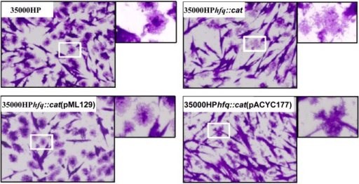 What is Chancroid? - Pathosomes