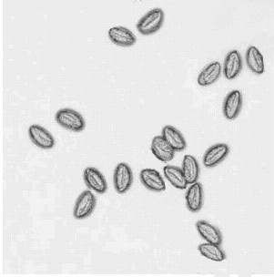 What are Metazoal Parasitic Infections? - Pathosomes