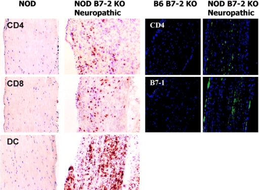 What are the Patterns of Peripheral Neuropathies? - Pathosomes