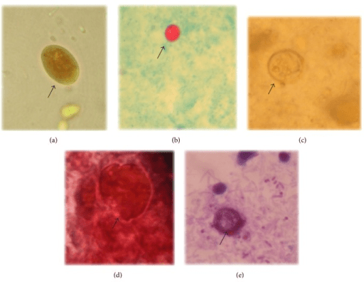 What are Protozoal Parasitic Infections? - Pathosomes