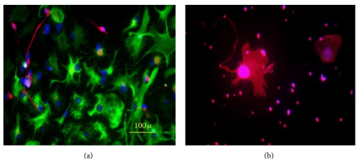 What are Stem Cells? - Pathosomes
