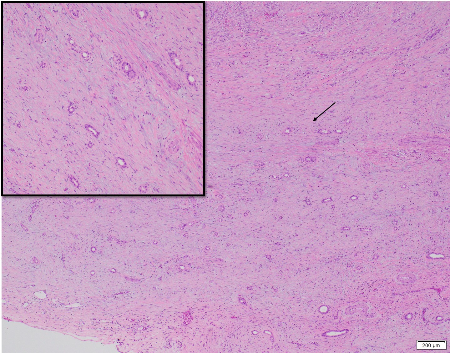 Case 3: Quarter 3, 2019