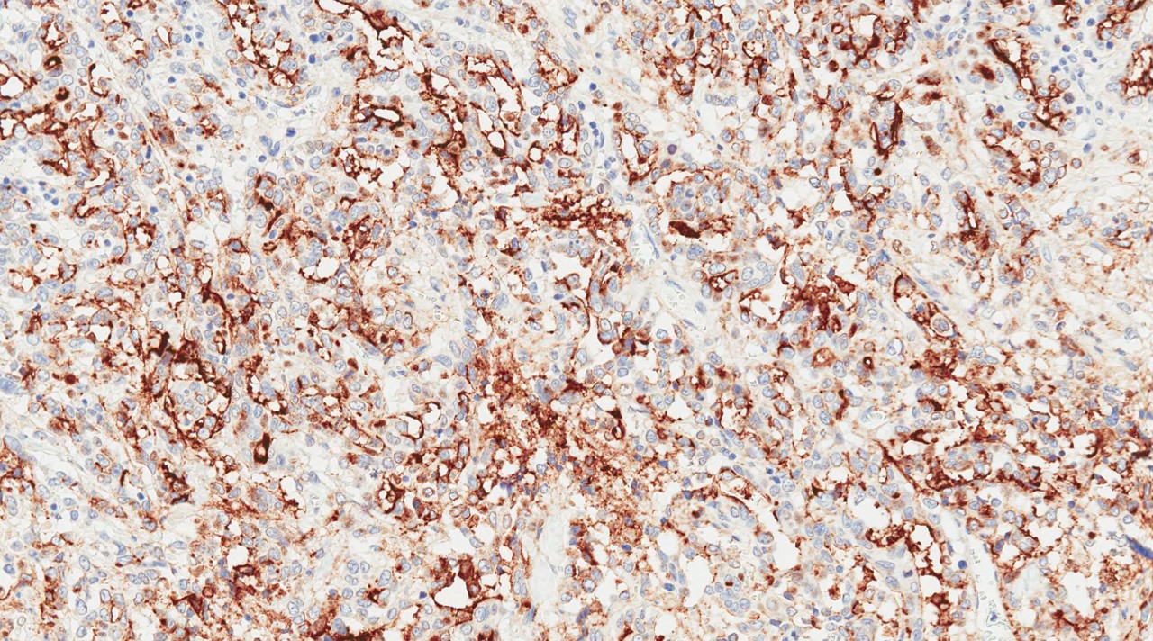 Case 4: Quarter 4, 2019