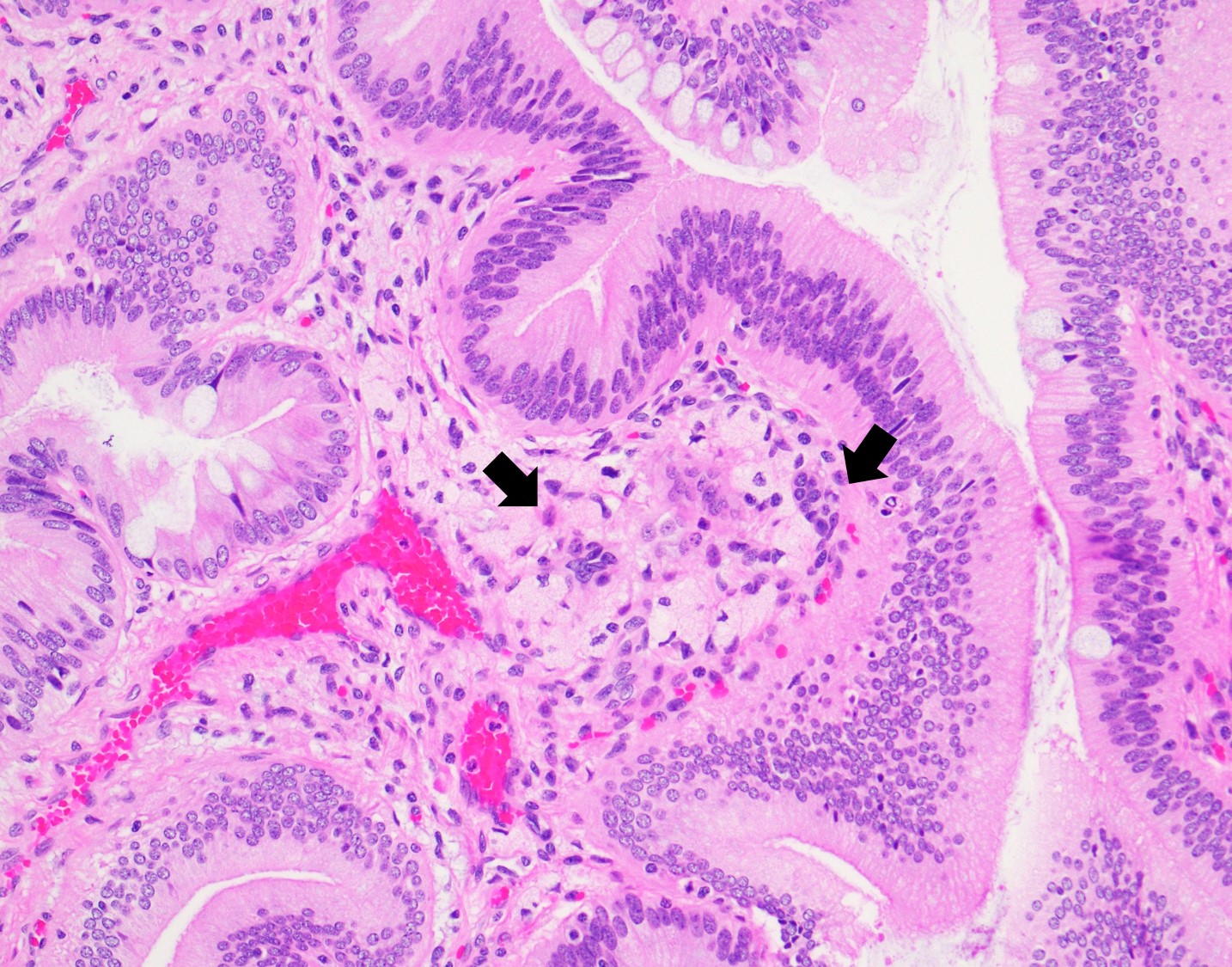 Case 4: Quarter 3, 2021