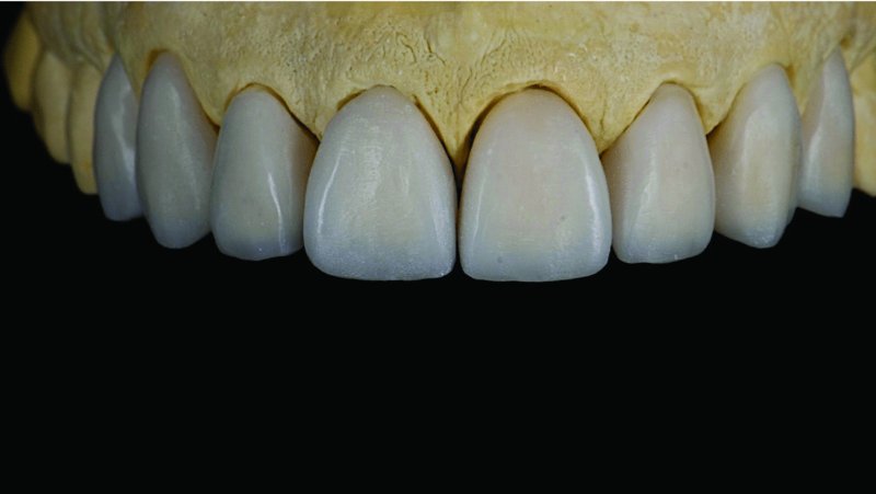 Digital Smile Evaluation | Pocket Dentistry