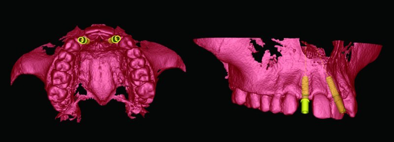 Pre-operative Evaluation | Pocket Dentistry