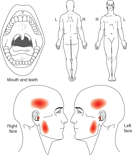 Masticatory Muscle Disorders | Pocket Dentistry