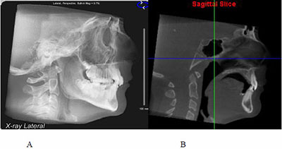 Diagnosis and Treatment Planning | Pocket Dentistry