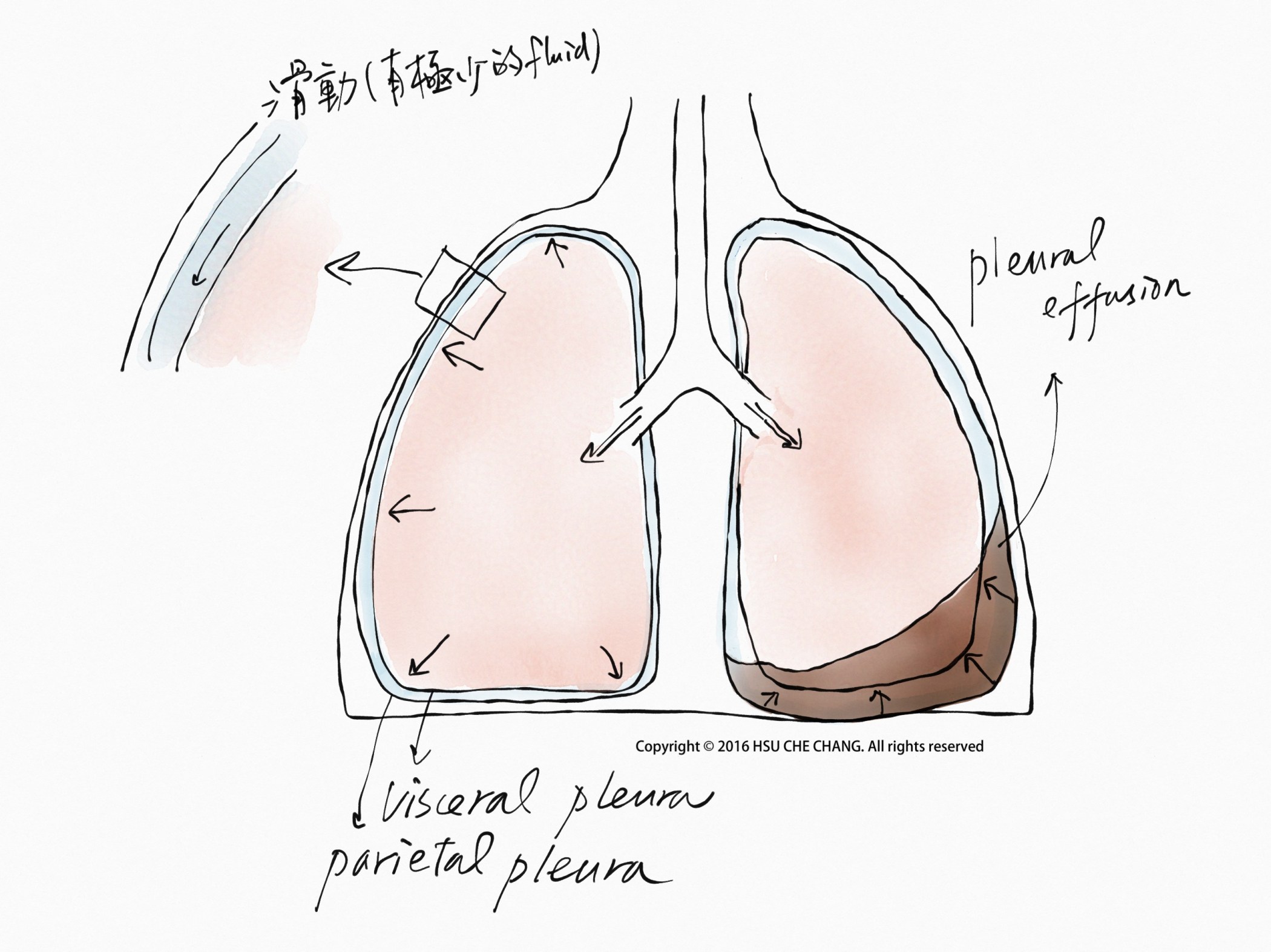 [Sonoanatomy] Lung (rib, pleura, A－line, lung sliding) – POCUS Academy