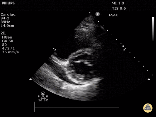 saxtamp | POCUS BASICS .org