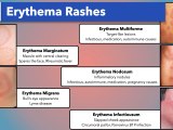 Pediatric Rashes