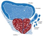Signs And Symptoms