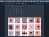Machine Learning Project Skin Cancer Classification Project Gurukul