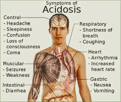 Symptoms of Metabolic acidosis - PT Master Guide