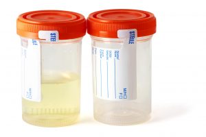 Quickfix for Clean Catch Urine Sample: Can You Use Synthetic Urine?