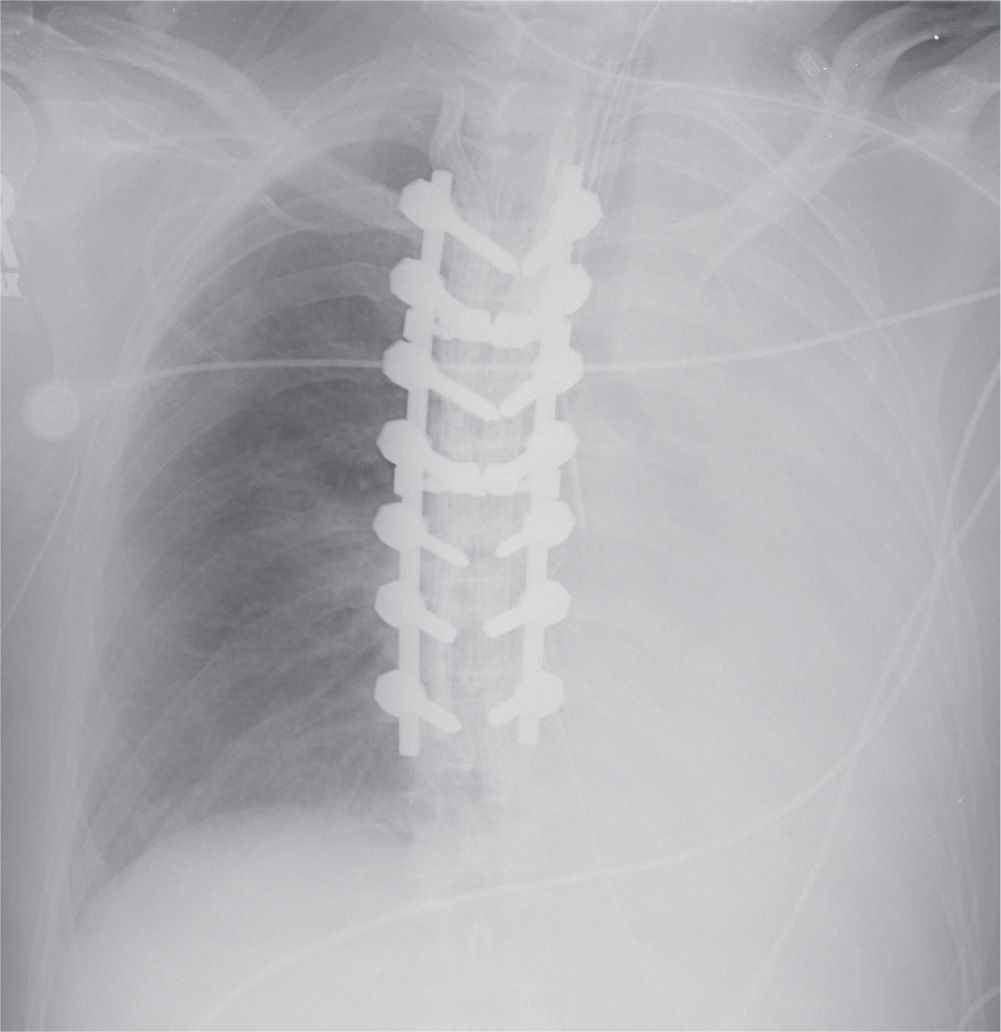 Monitoring and Support Devices: “Tubes and Lines” | Radiology Key